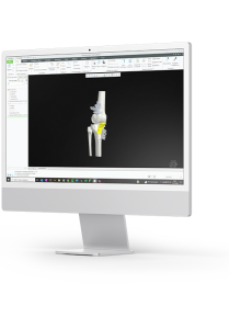 PSI - Patient Solution Specific - Newclip Technics