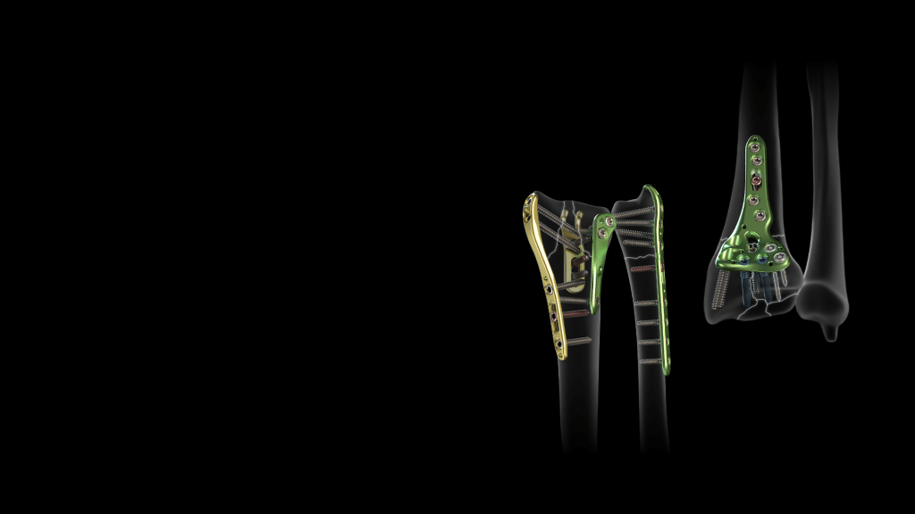 Upper Limb. - Newclip Technics