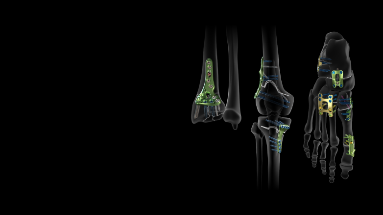 Documentation Upper Limb. - Newclip Technics