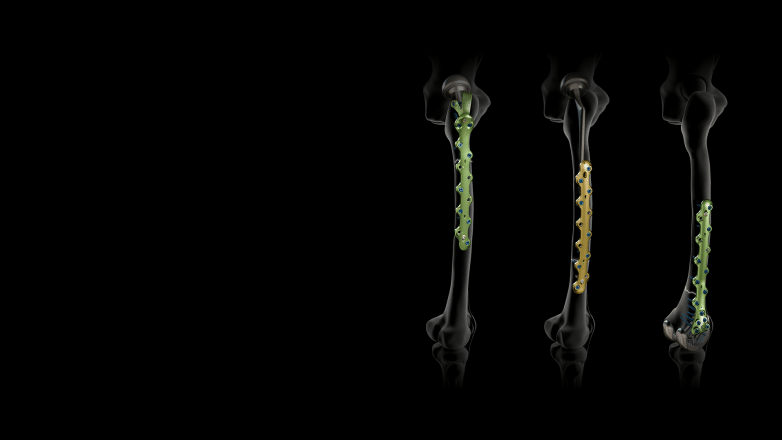 Hip. - Newclip Technics