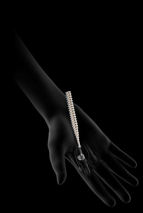 Kemis - Soft tissues surgery - Newclip Technics