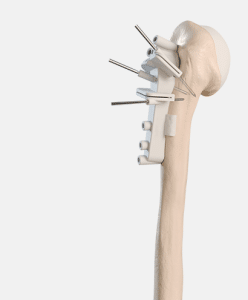 PSI - Patient-Specific Solution. - Newclip Technics